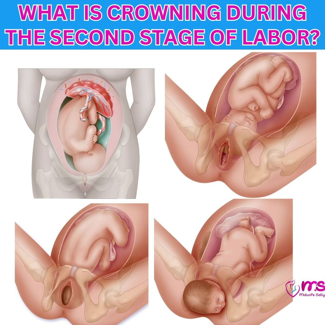 human birth crowning